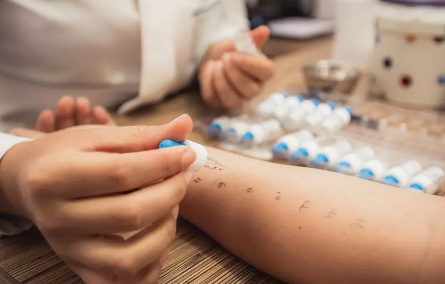 Teste de Alergia Gratuito para moradores do Rio de Janeiro e Baixada ...